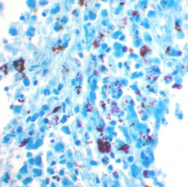 Ziehl - Neelsen (Bacterias ácido-alcohol resistentes) - kit - 1 Kit ...